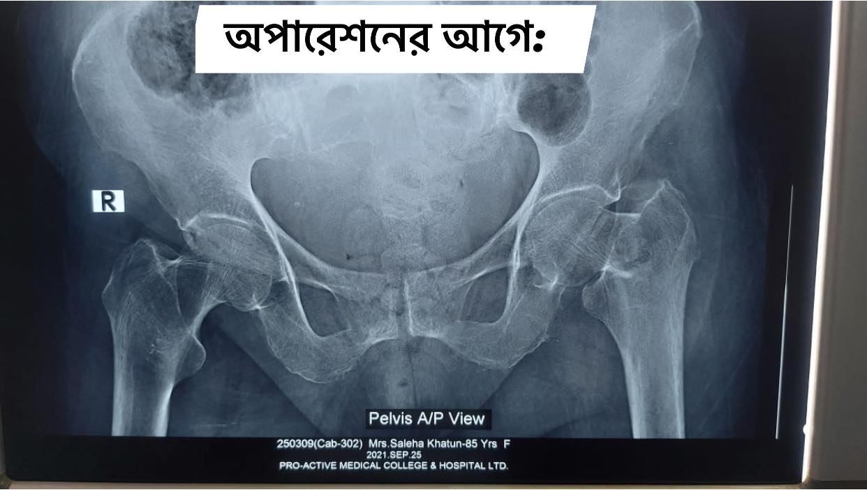 Best Arthroplasty Surgeon 2024 || Dr. Md. Emdadul Hoque Bhuiyan